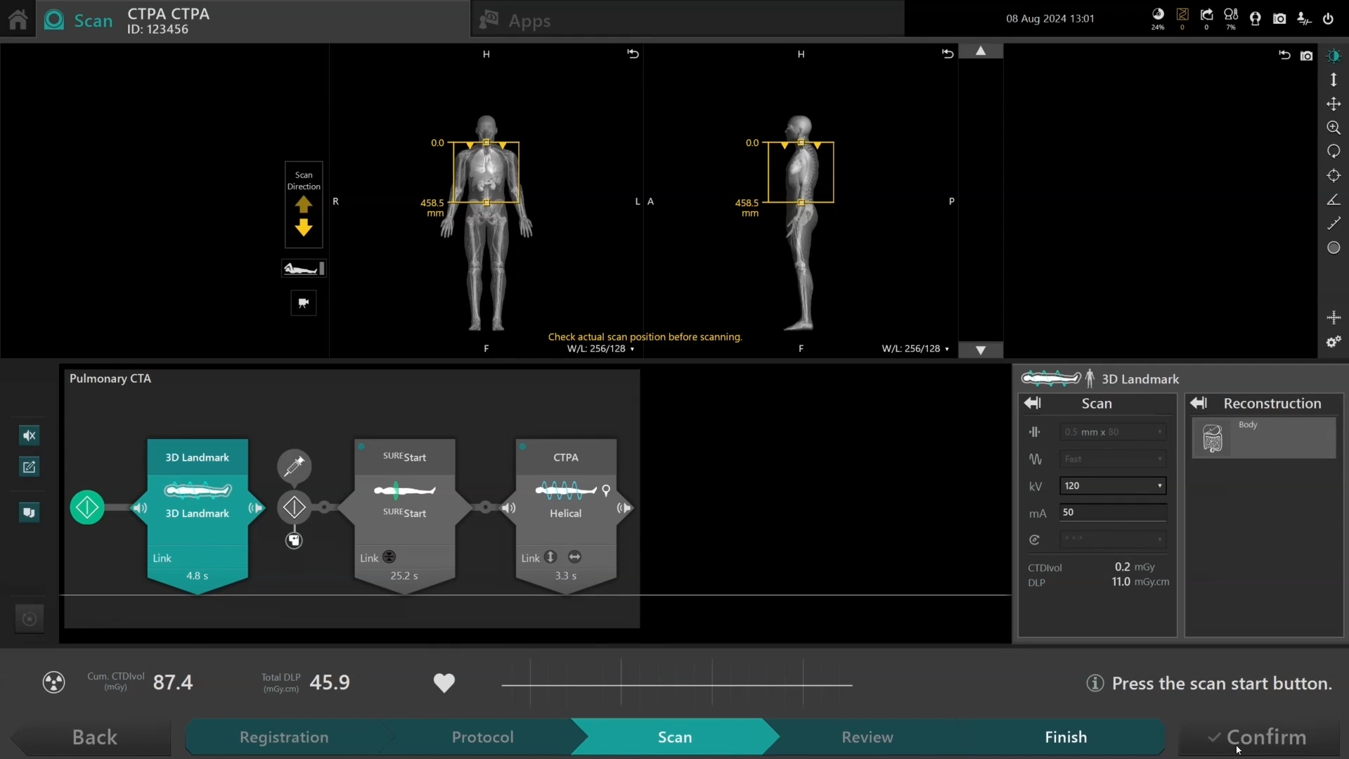 Canon Medical Academy - INSTINX: CTPA Scanning